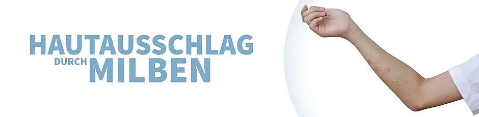 Juckender Ausschlag durch Milben: Ursachen und Behandlung